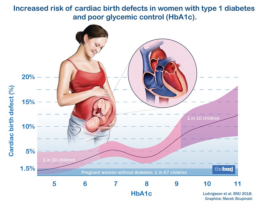 Higher risk of heart defects in babies of mothers with type 1 diabetes ...