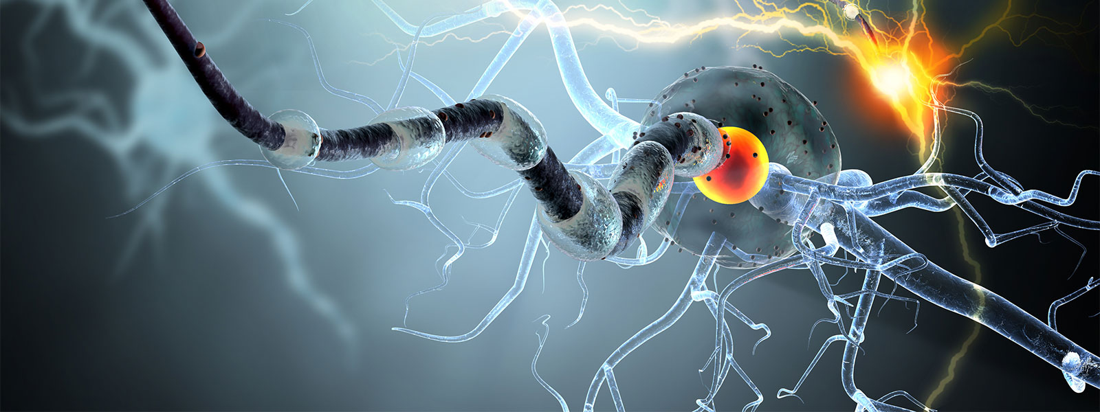 New explanation for the cause of MS | Karolinska Institutet