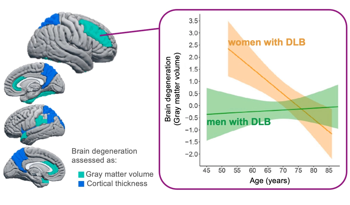 A type of dementia that hits the brain of men and women differently ...