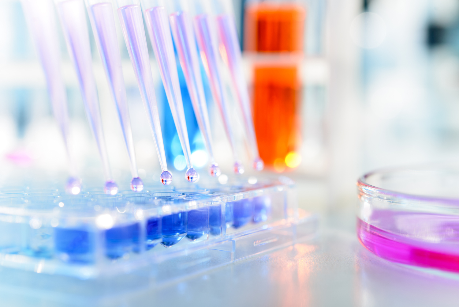 Knut and Alice Wallenberg Foundation awards Scholar grants to 19 KI ...