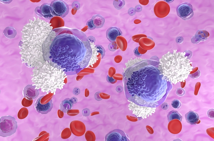 Genetic Marker May Guide New Acute Leukemia Treatment | Mirage News