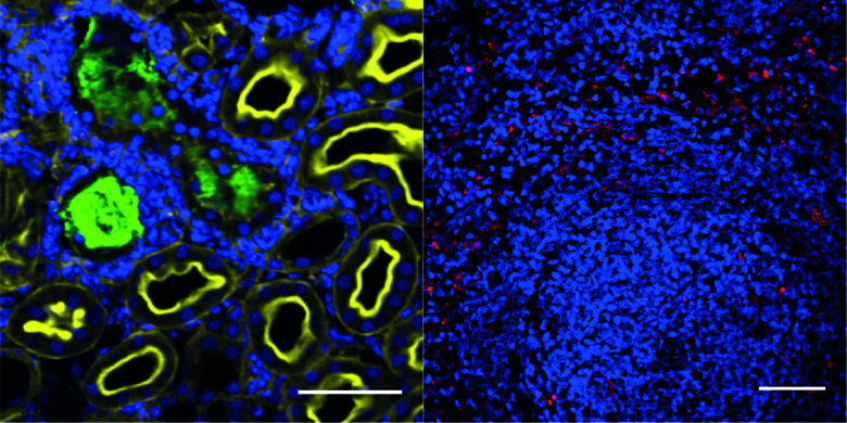 Nerve signaling alerts the host to bacterial infection within hours ...
