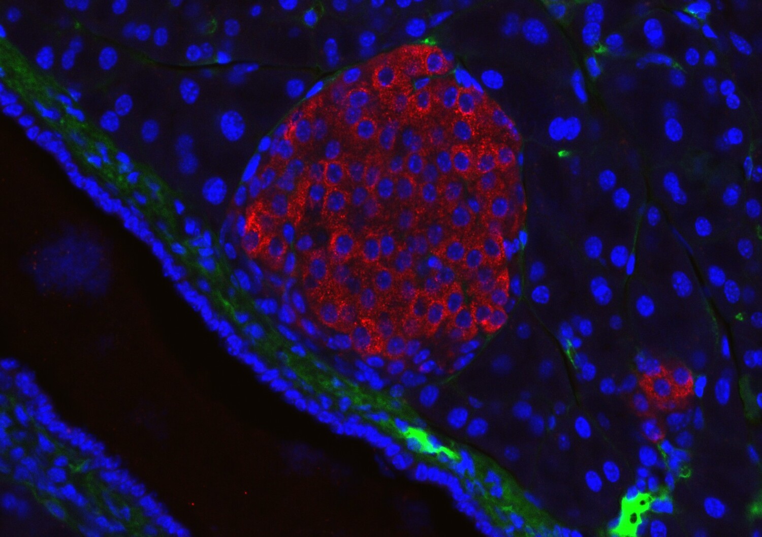 New Window Into Pancreatic Islet Cell Function | Mirage News