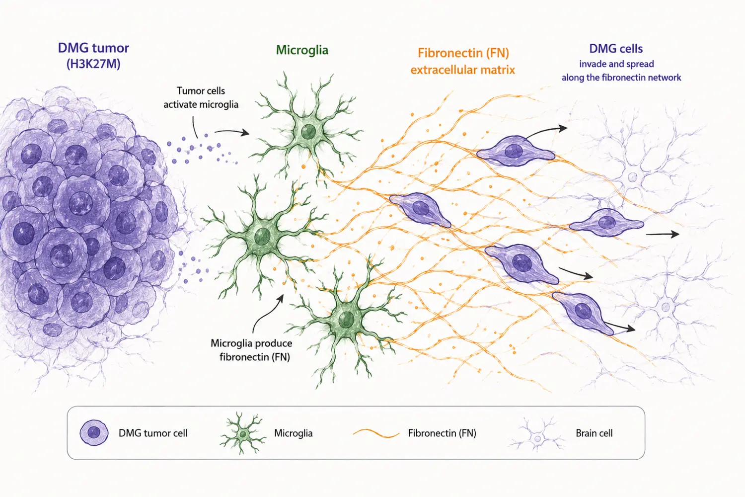 Microglia can drive aggressive brain tumors in children | Karolinska ...
