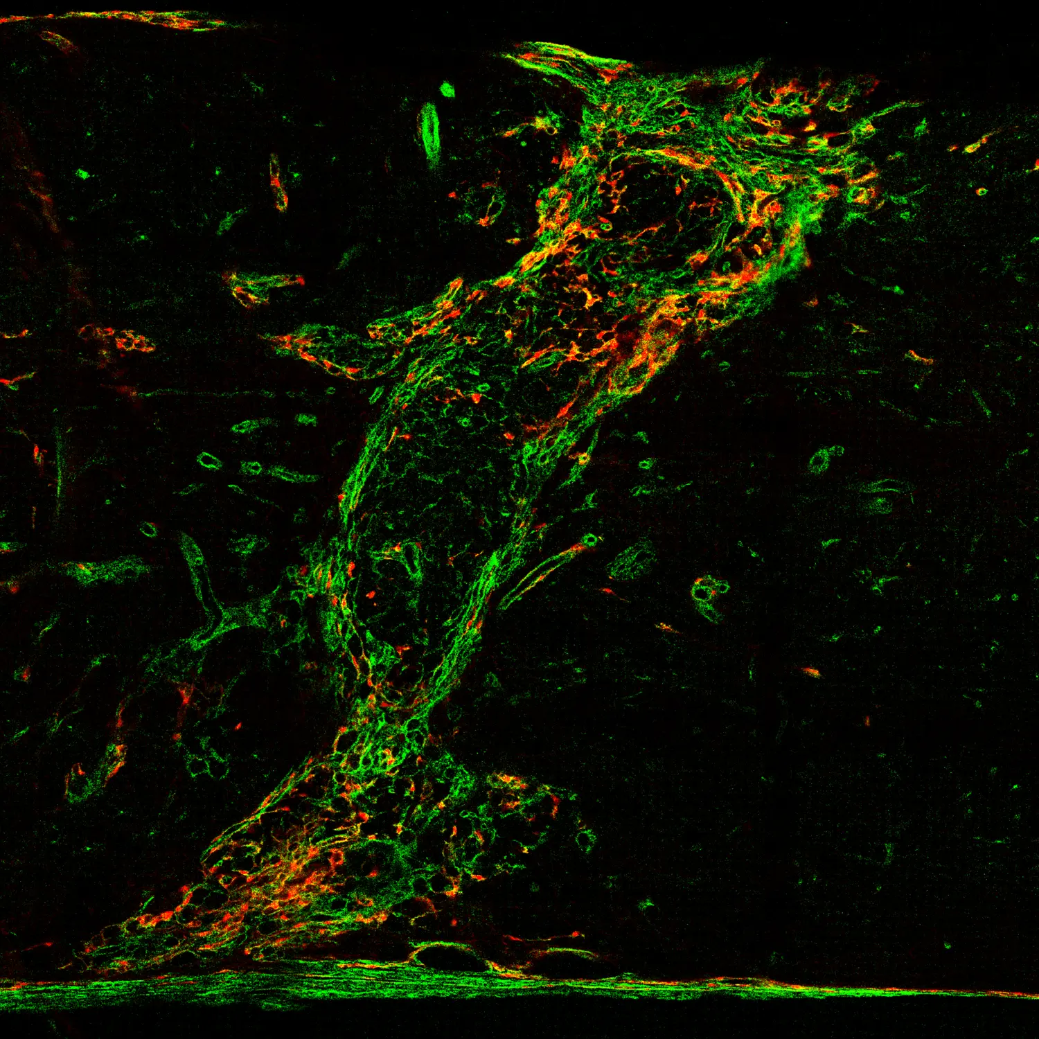 Spinal Cord Injury Scar Formation More Complex Than Believed | Mirage News