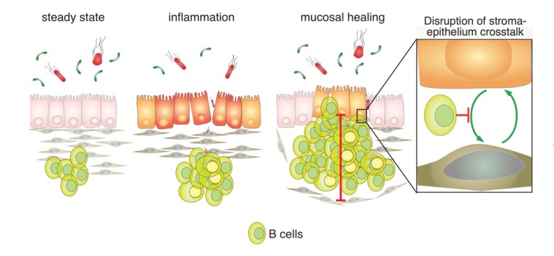 Common immune cells can prevent intestinal healing | Karolinska Institutet